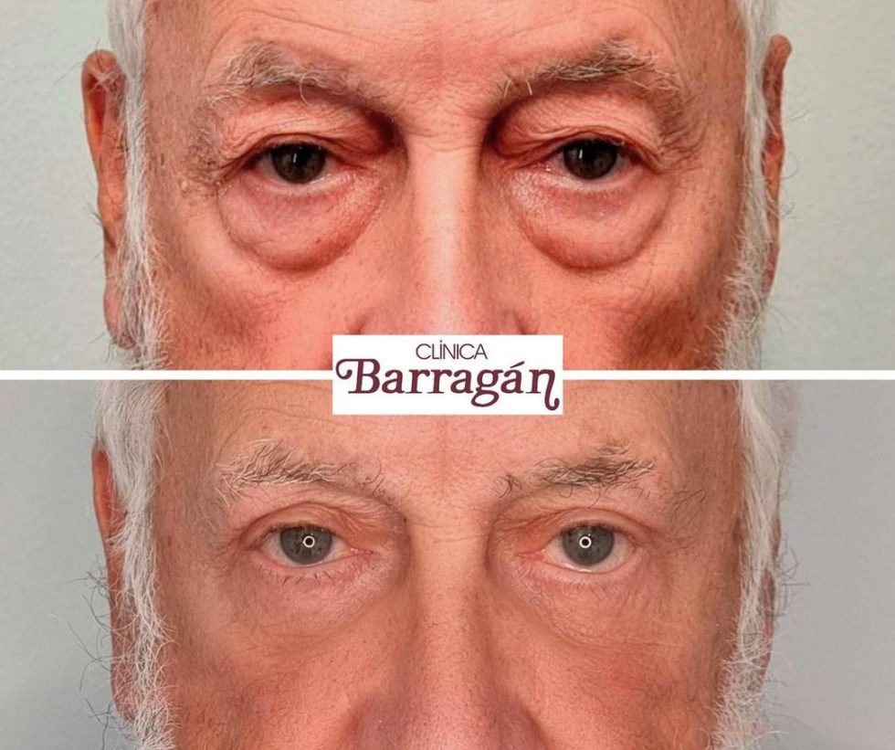 EL DOCTOR FERNANDO BARRAGÁN NOS ACLARA LAS DUDAS ACERCA DE LA ...